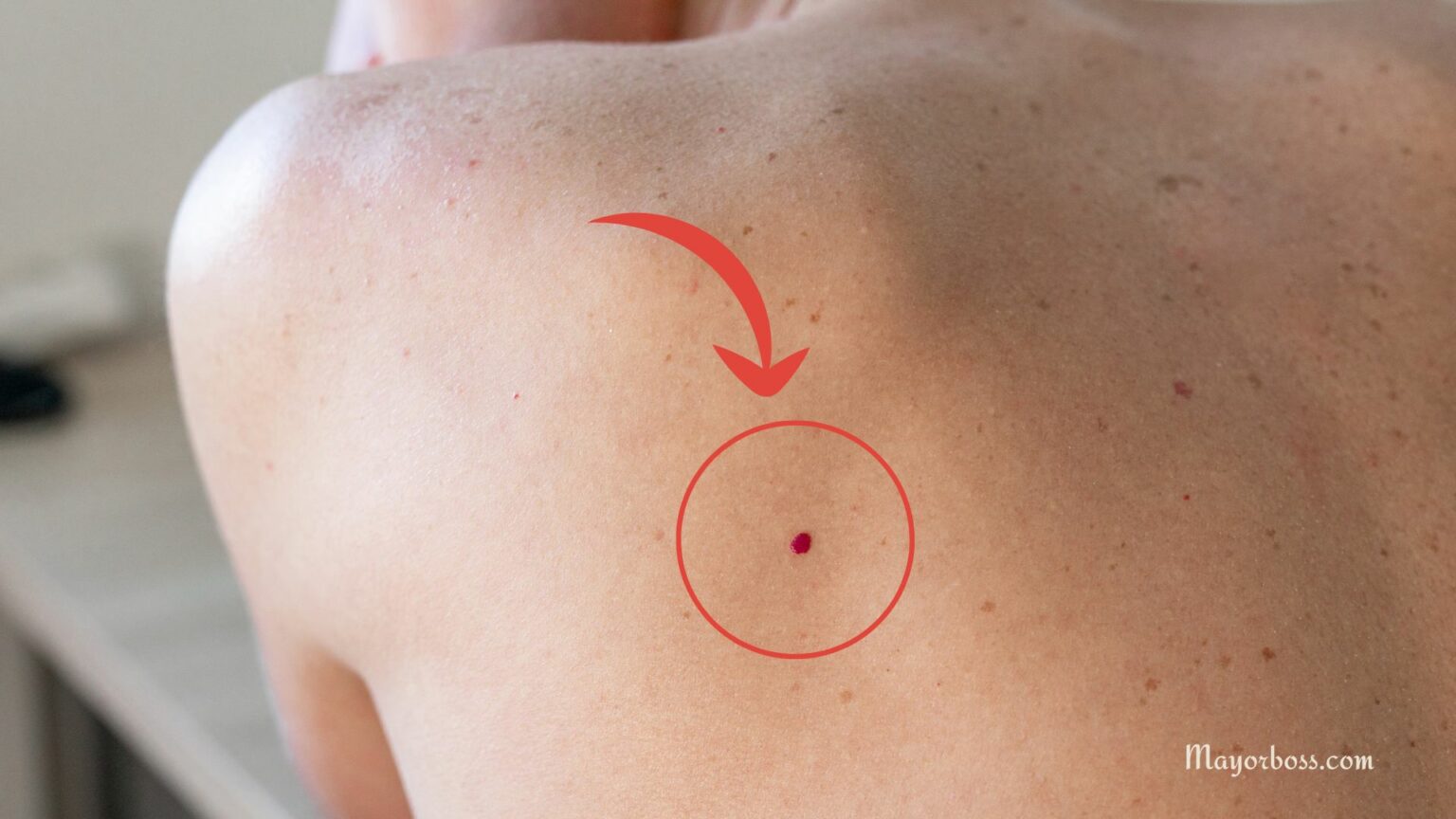 What It Means When You Have Little Red Dots on Your Skin